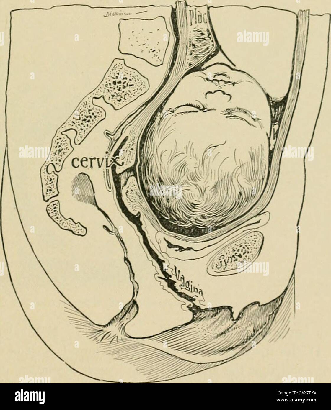 The American text-book of obstetrics for practitioners and students ...