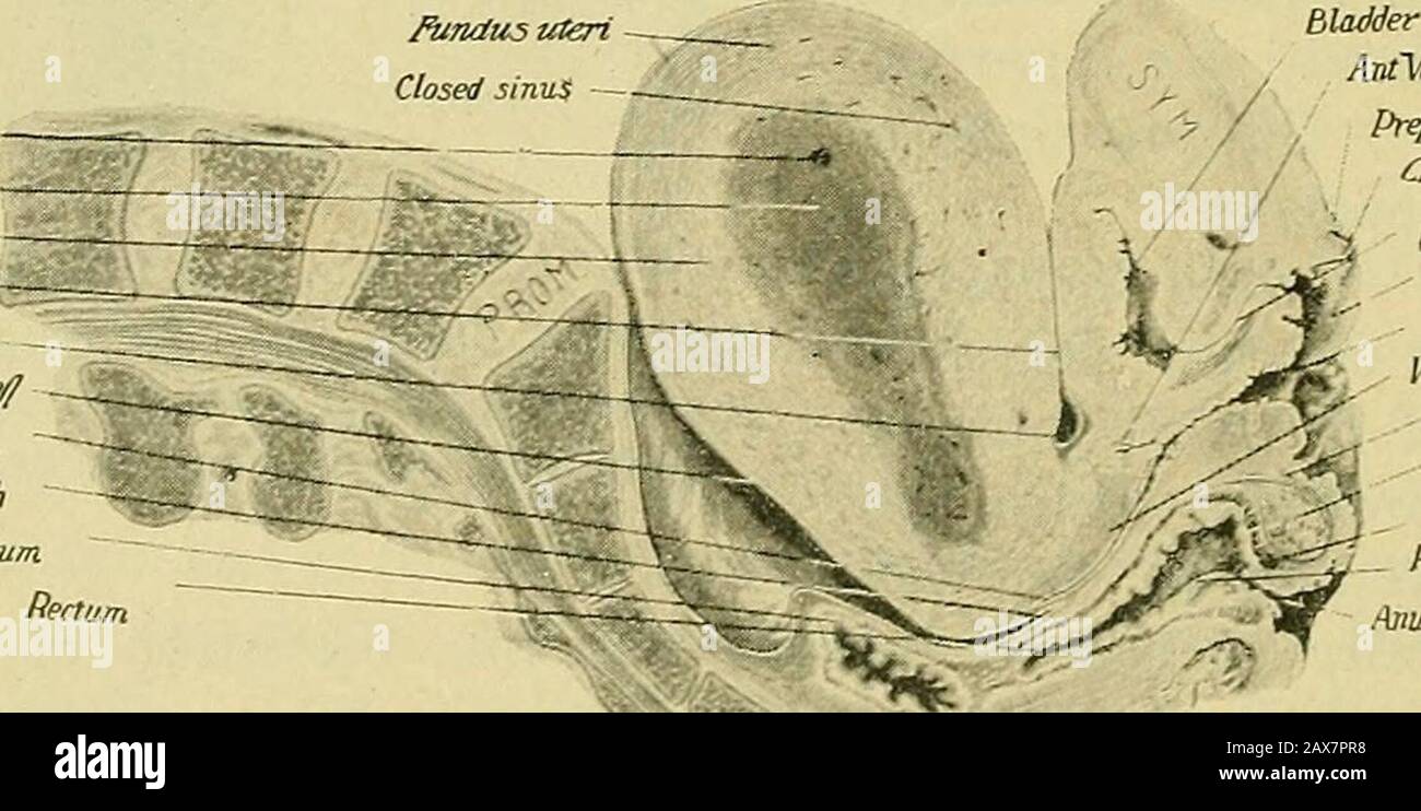 Prepuce hi-res stock photography and images - Alamy