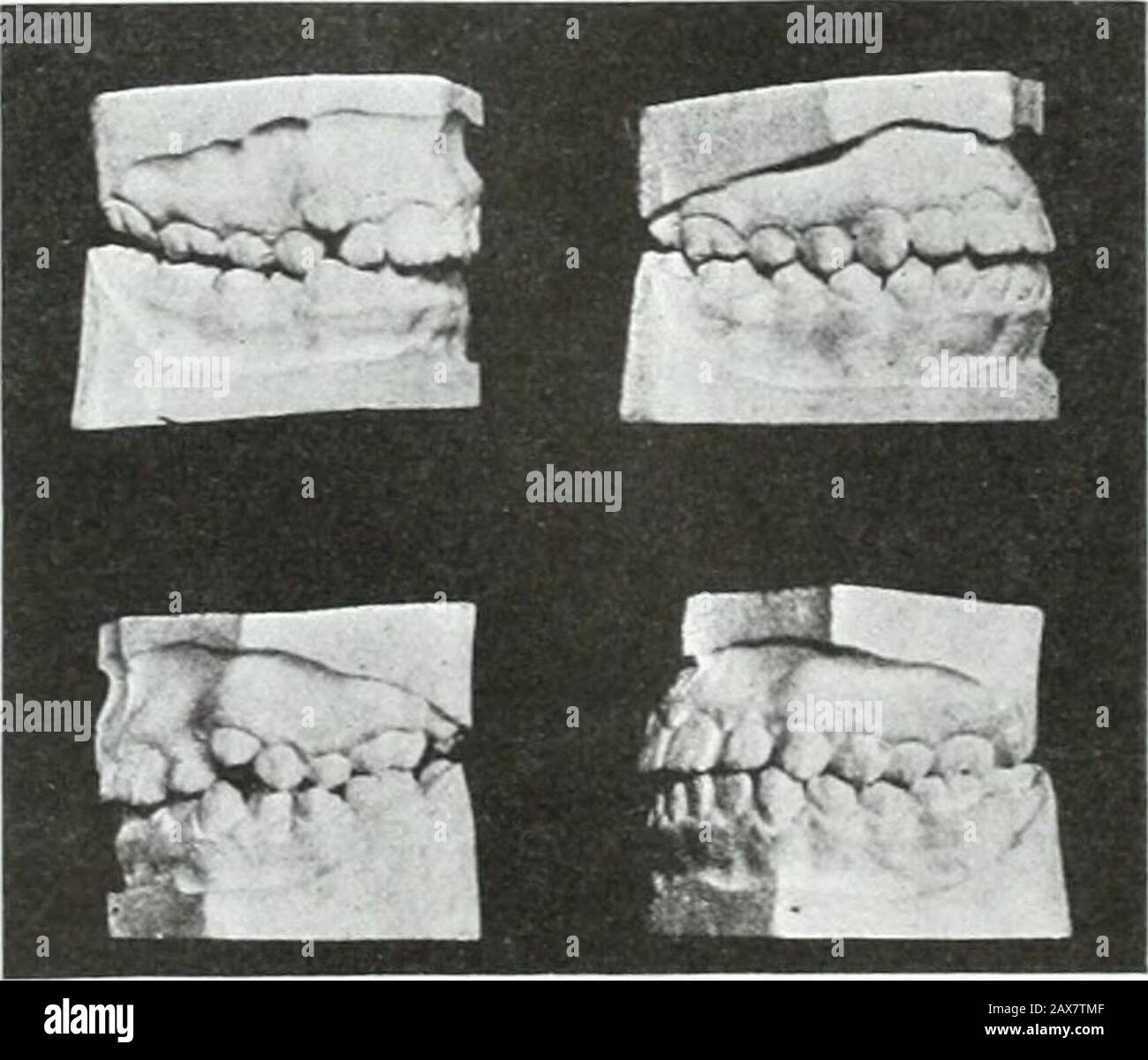 A practical treatise on the technics and principles of dental ...