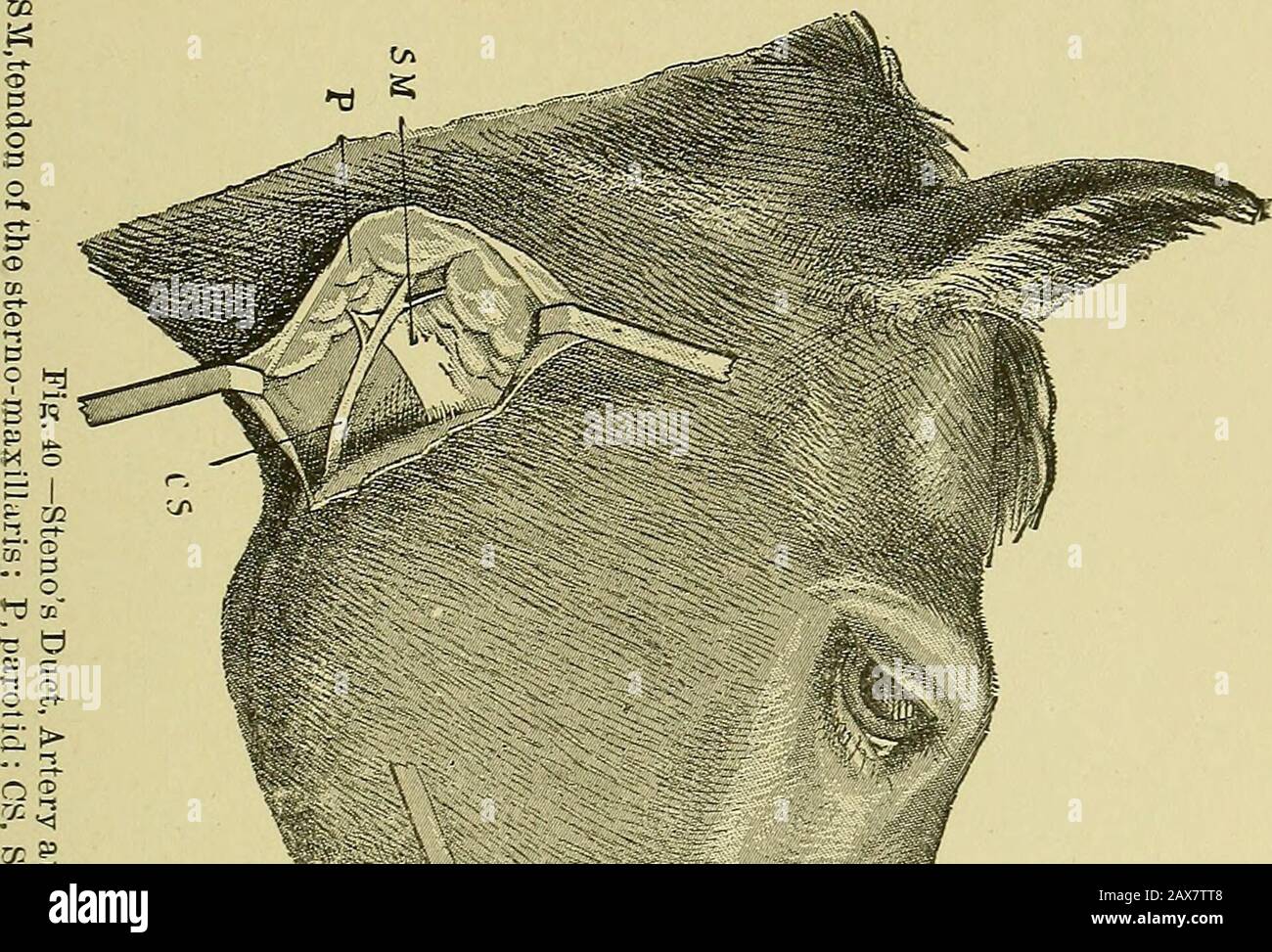 Cataract surgery instruments hi-res stock photography and images - Alamy