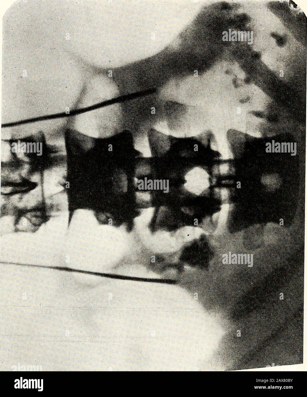 Epigastrium hi-res stock photography and images - Alamy