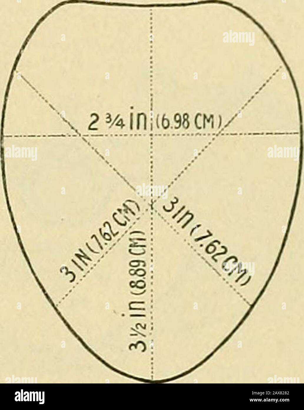 Tors diagram hi-res stock photography and images - Alamy