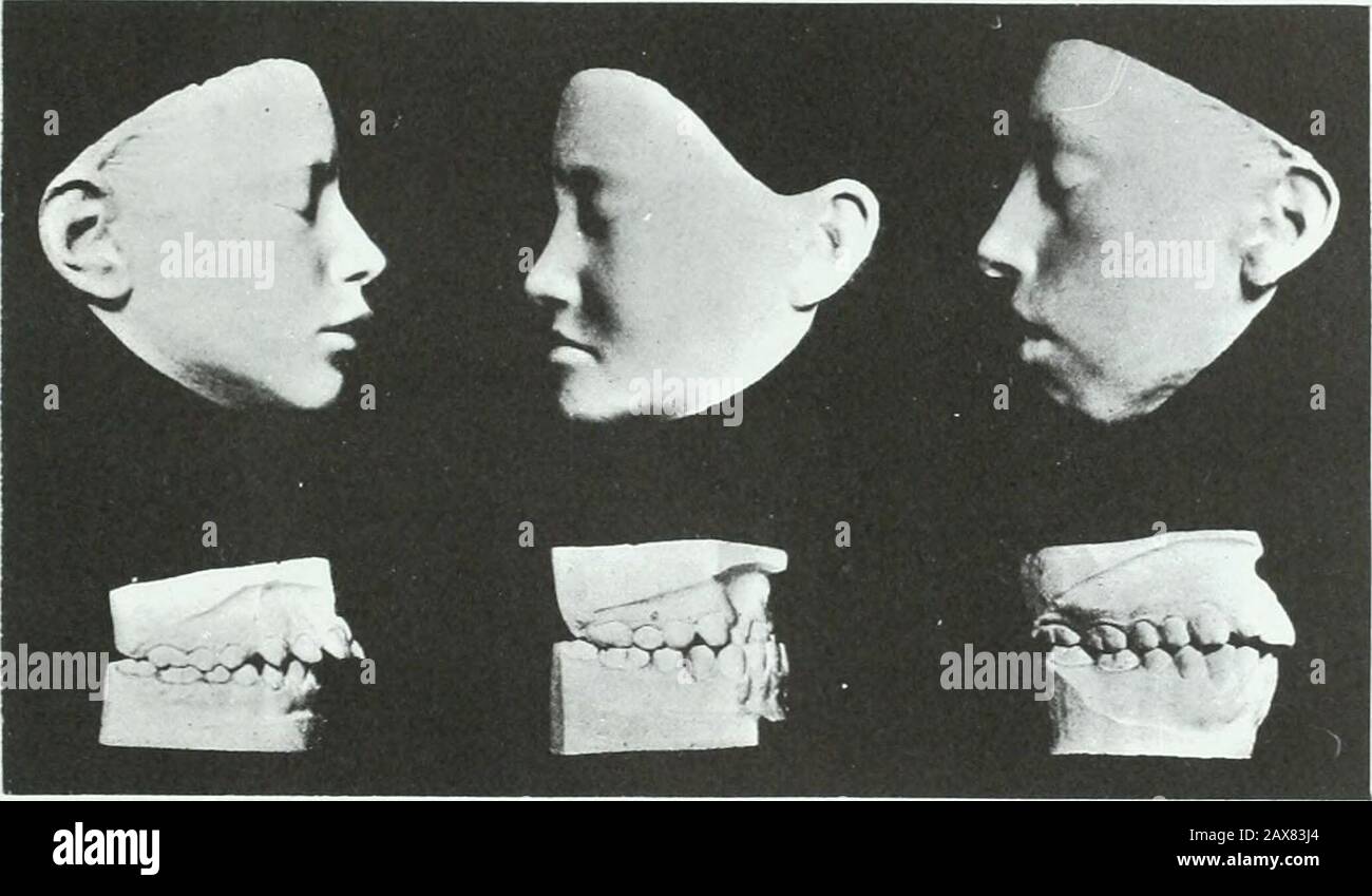 A practical treatise on the technics and principles of dental ...