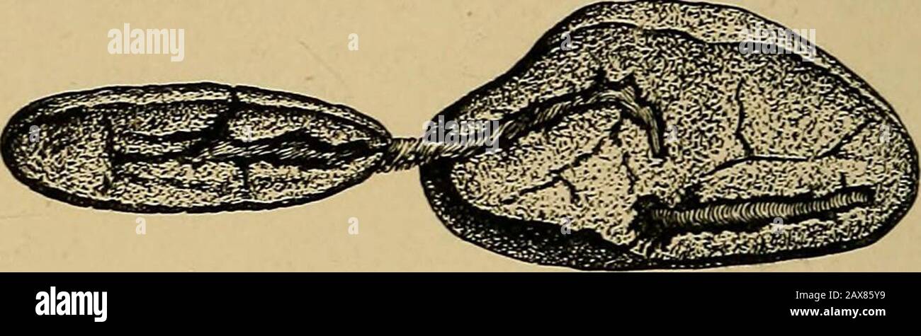 Threadin hi-res stock photography and images - Alamy