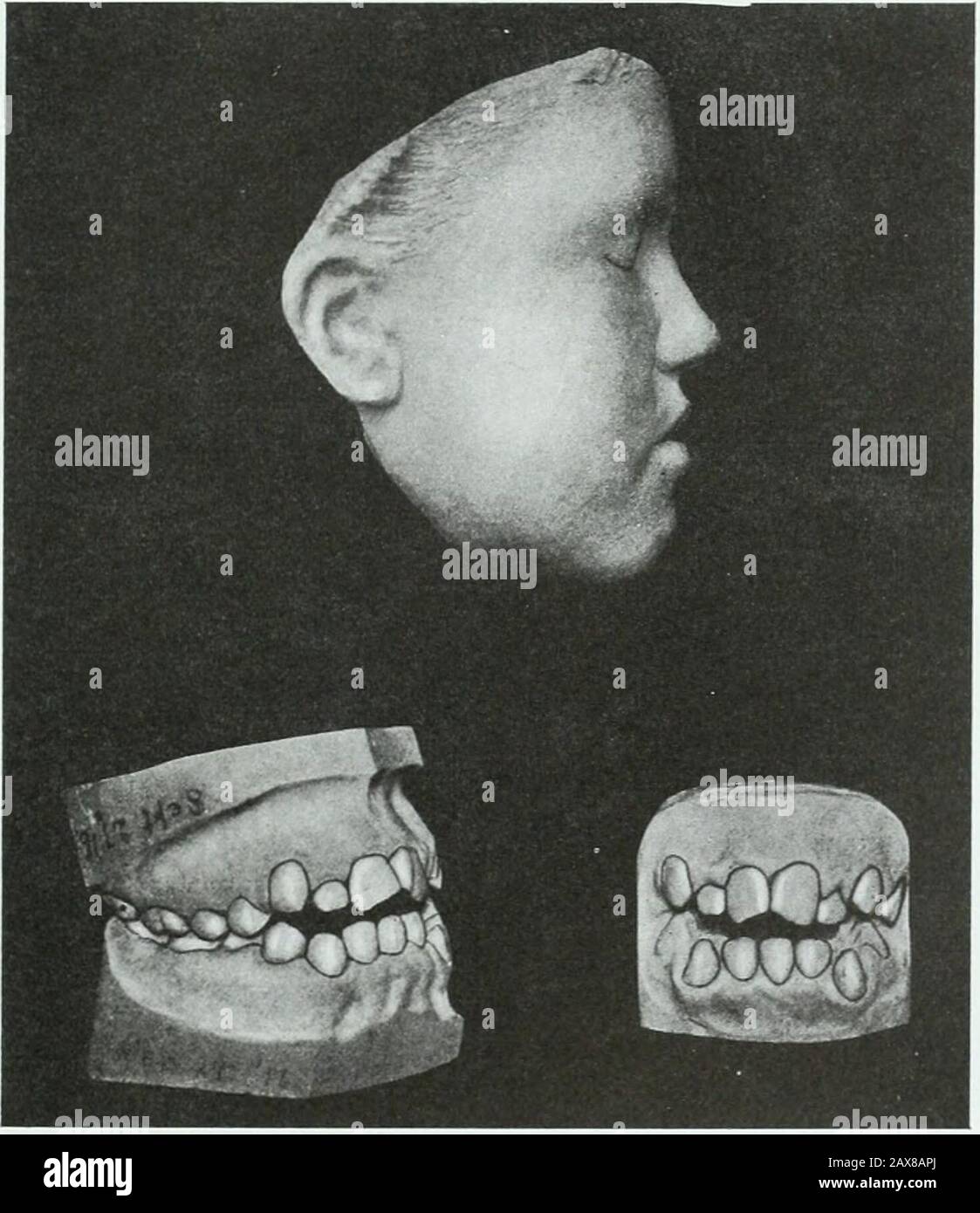 Orthopedia hi-res stock photography and images - Alamy