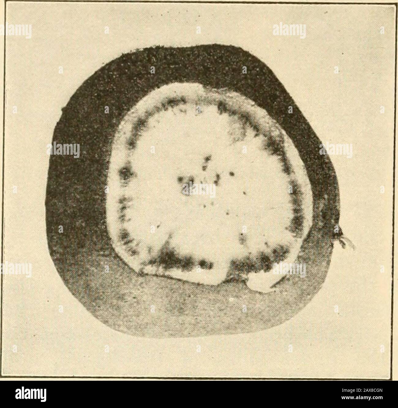 Blackspots hi-res stock photography and images - Alamy