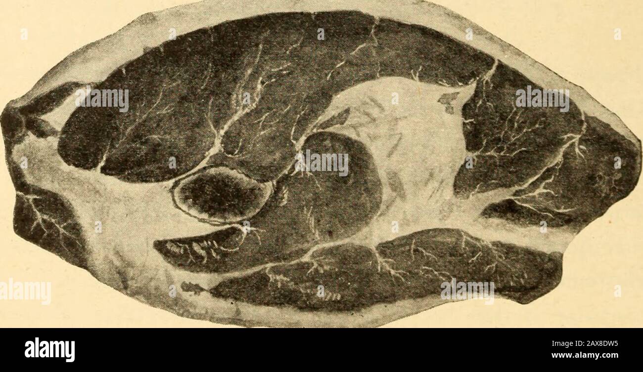 4 degree lean hi-res stock photography and images - Alamy