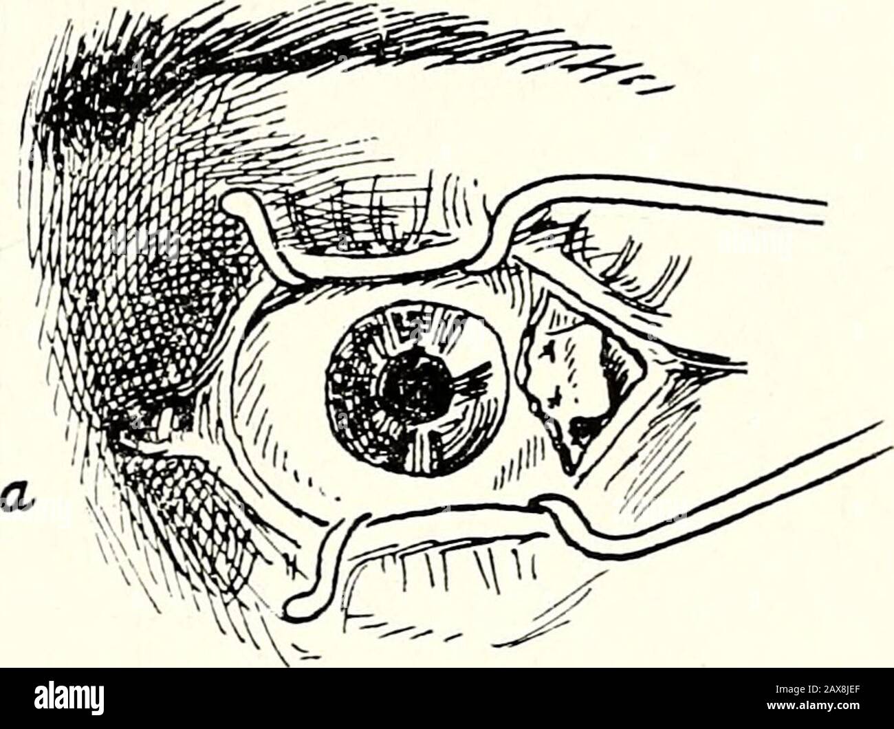 Case cian hi-res stock photography and images - Alamy