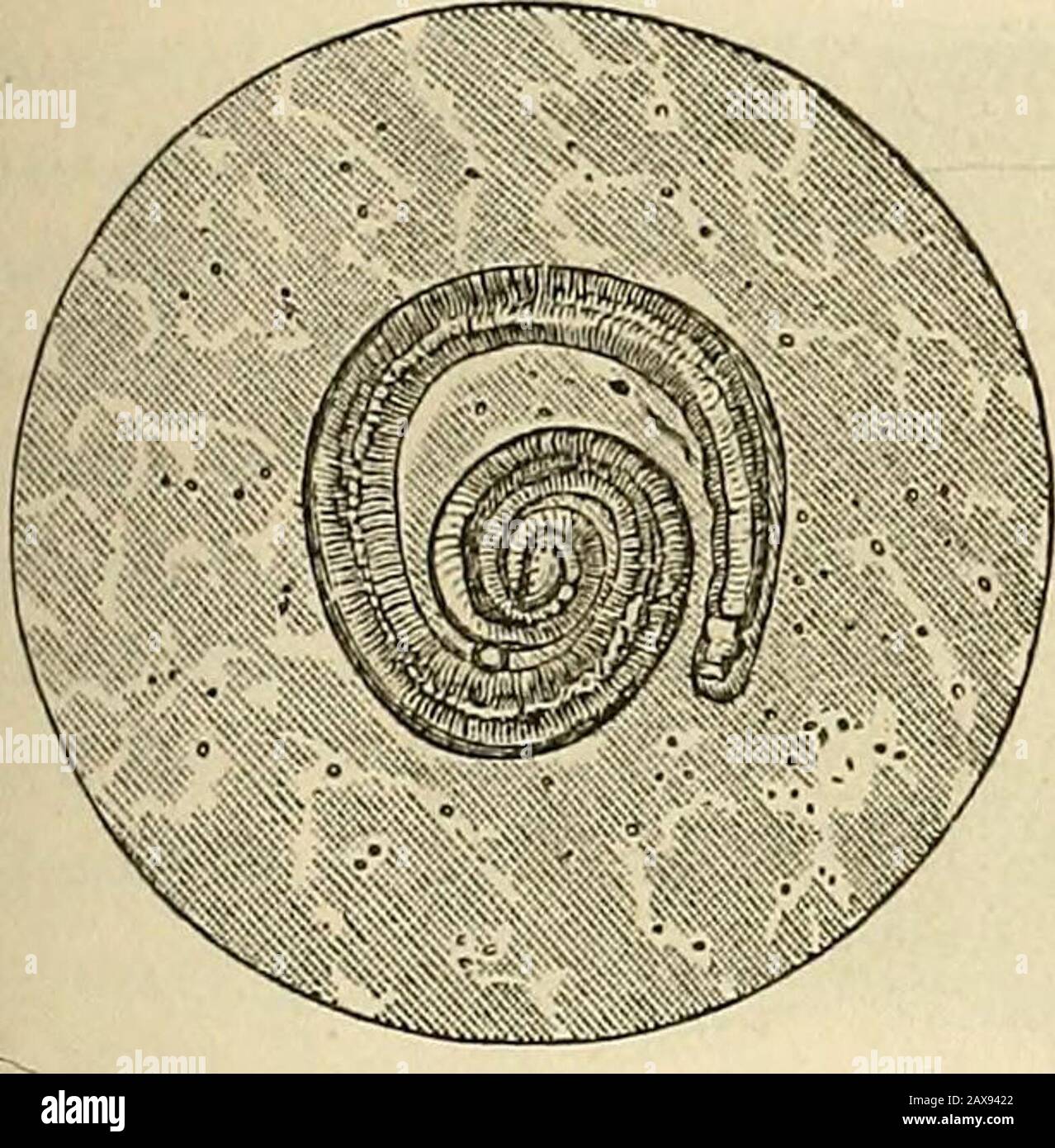 Unexplained illness hi-res stock photography and images - Alamy