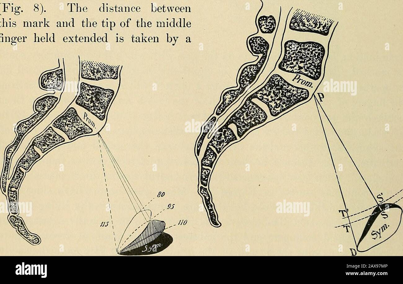 The American text-book of obstetrics for practitioners and students ...