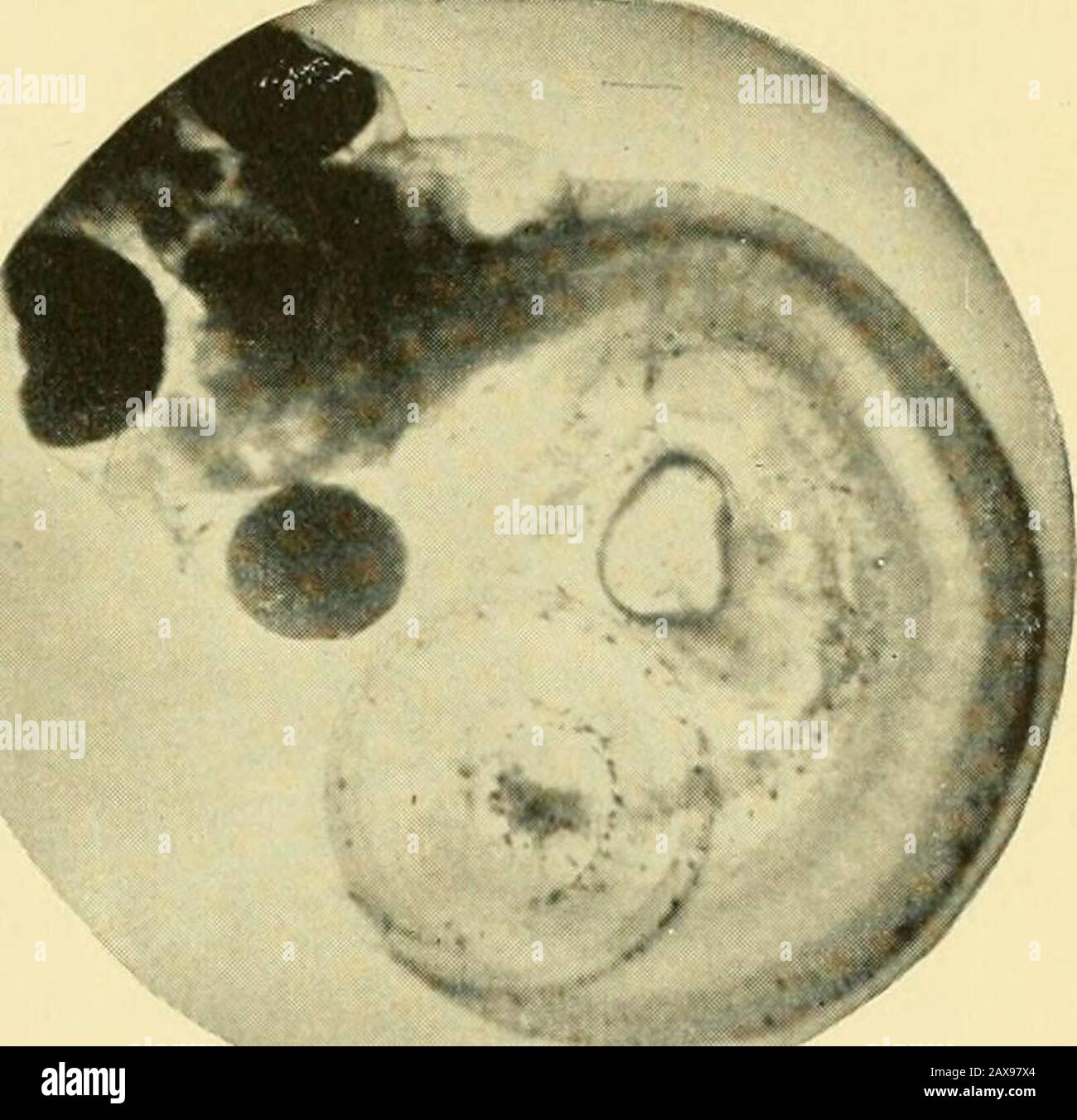 Deformity fish hi-res stock photography and images - Alamy