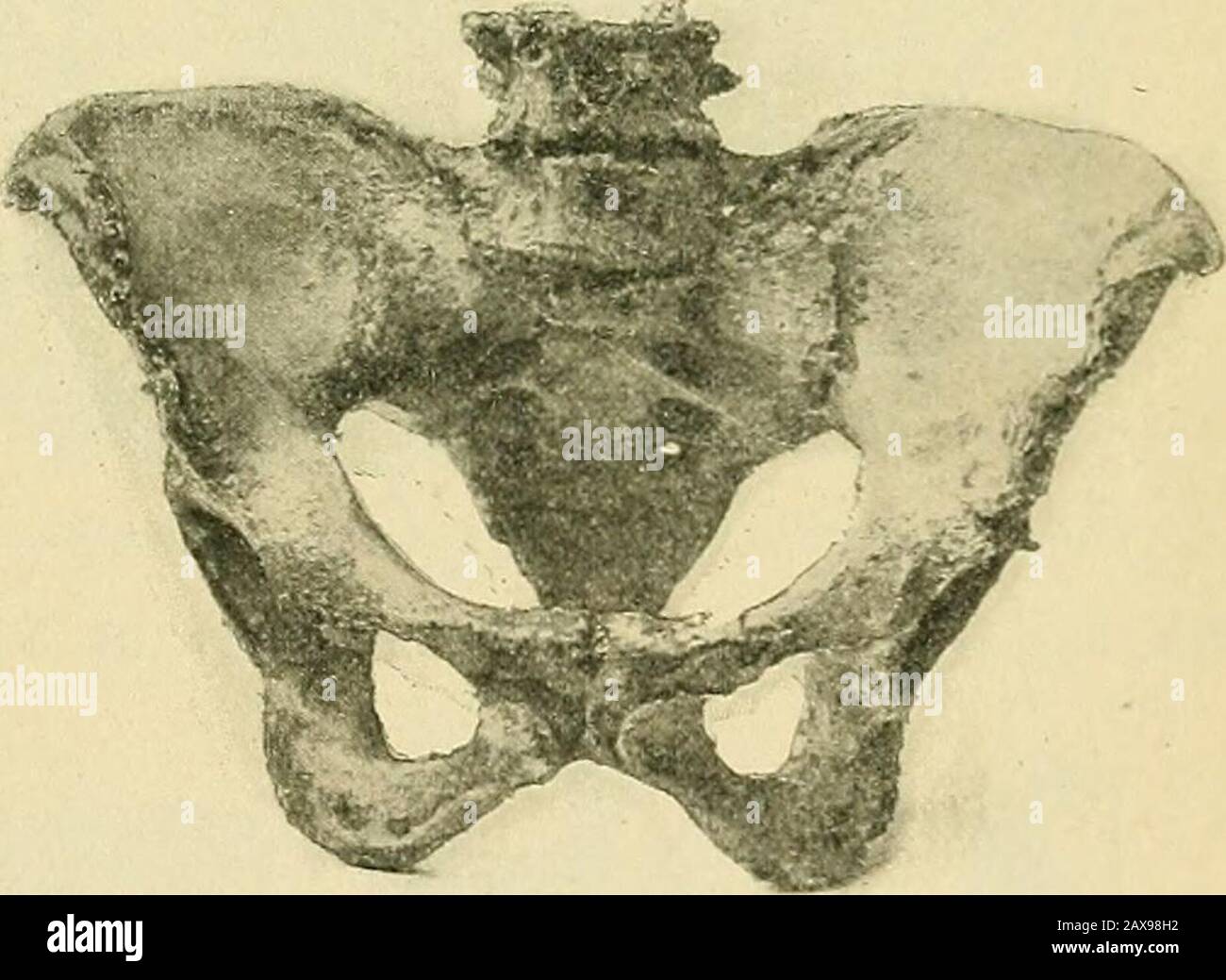 Oblong bone hi-res stock photography and images - Alamy