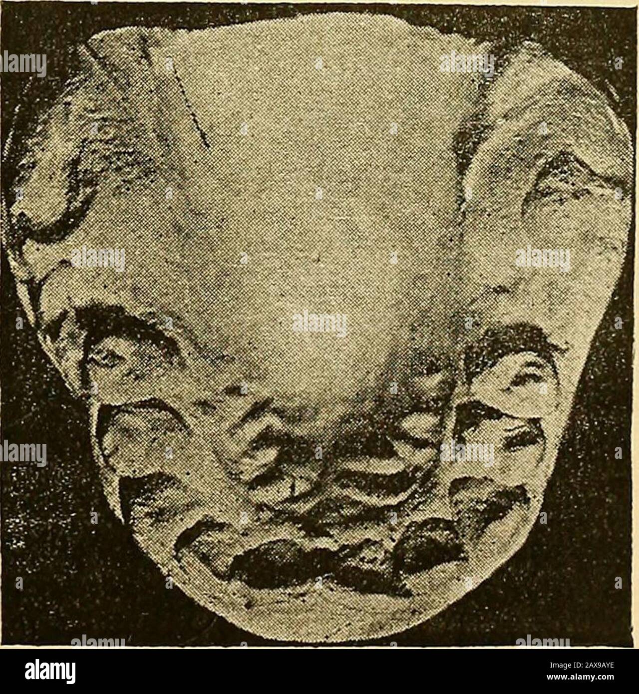 Étude anthropométrique sur les prostitueés et les voleuses . Fig. 4 ...