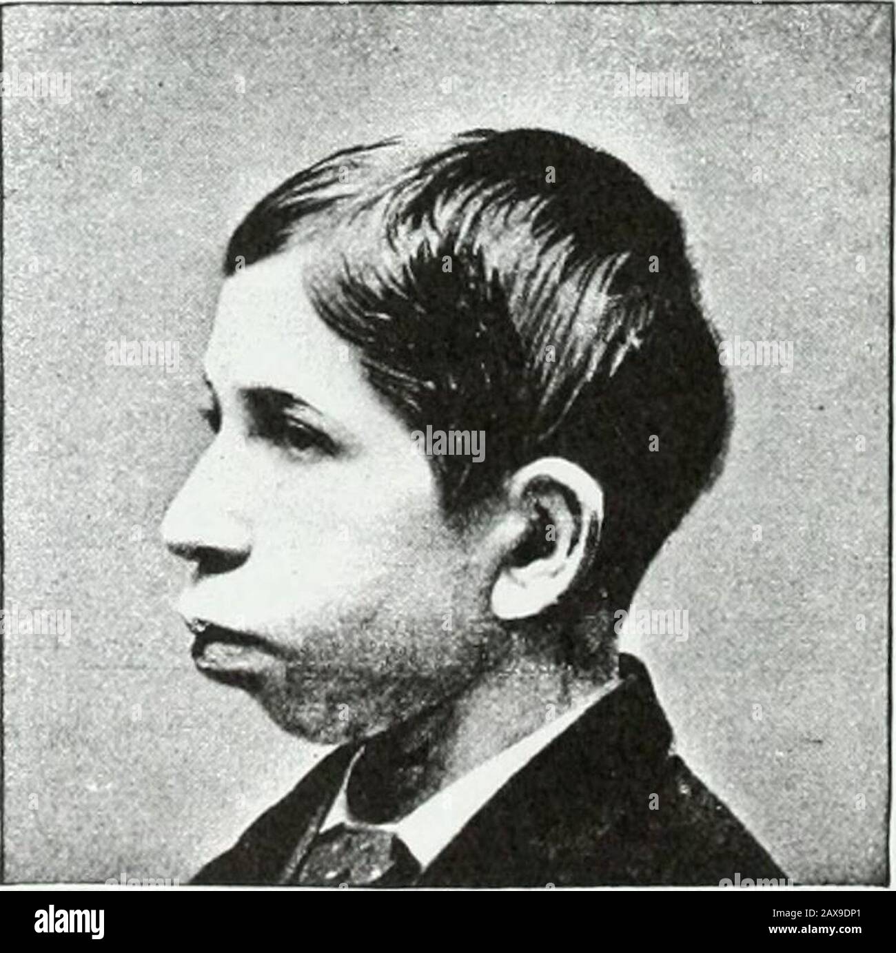 Prognathous hi-res stock photography and images - Alamy