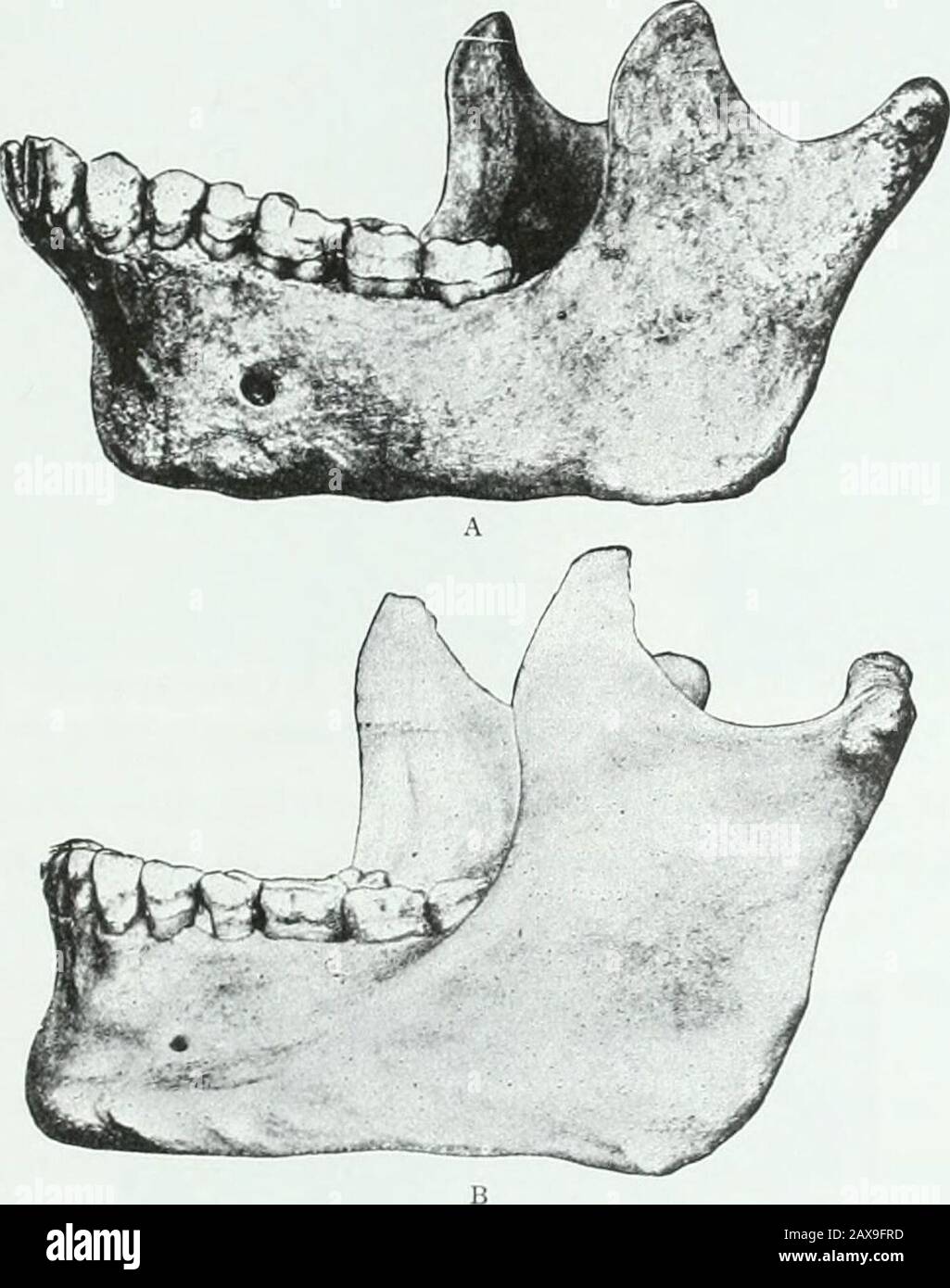A practical treatise on the technics and principles of dental ...
