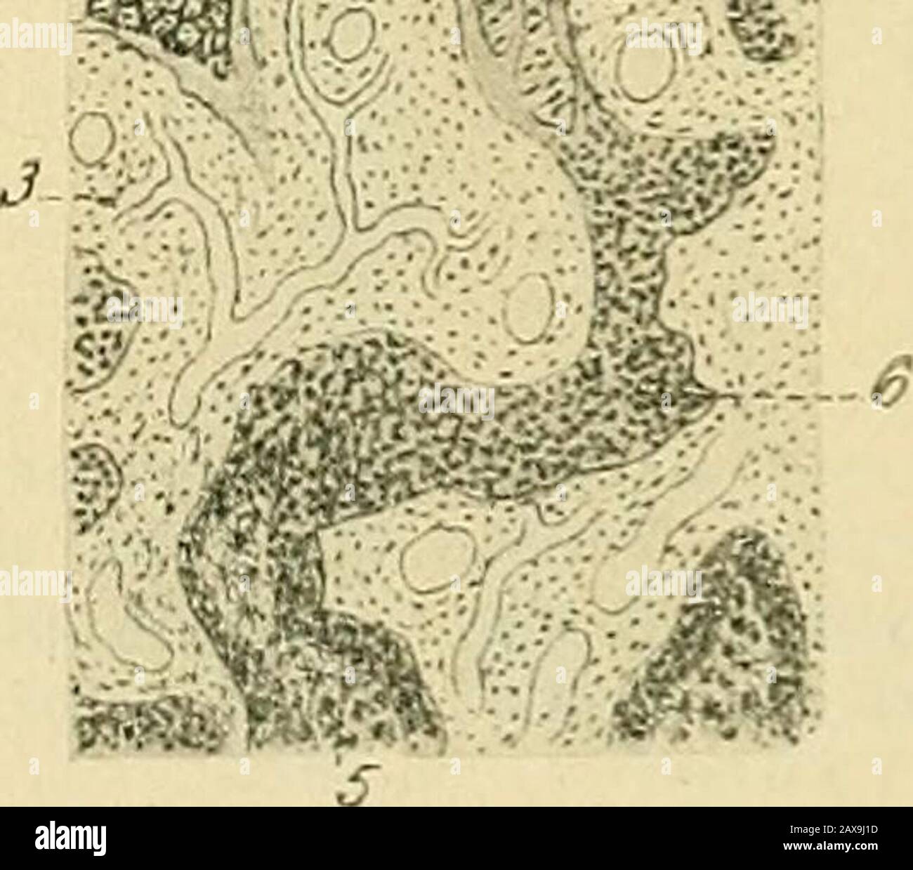 Proliferating cartilage hi-res stock photography and images - Alamy