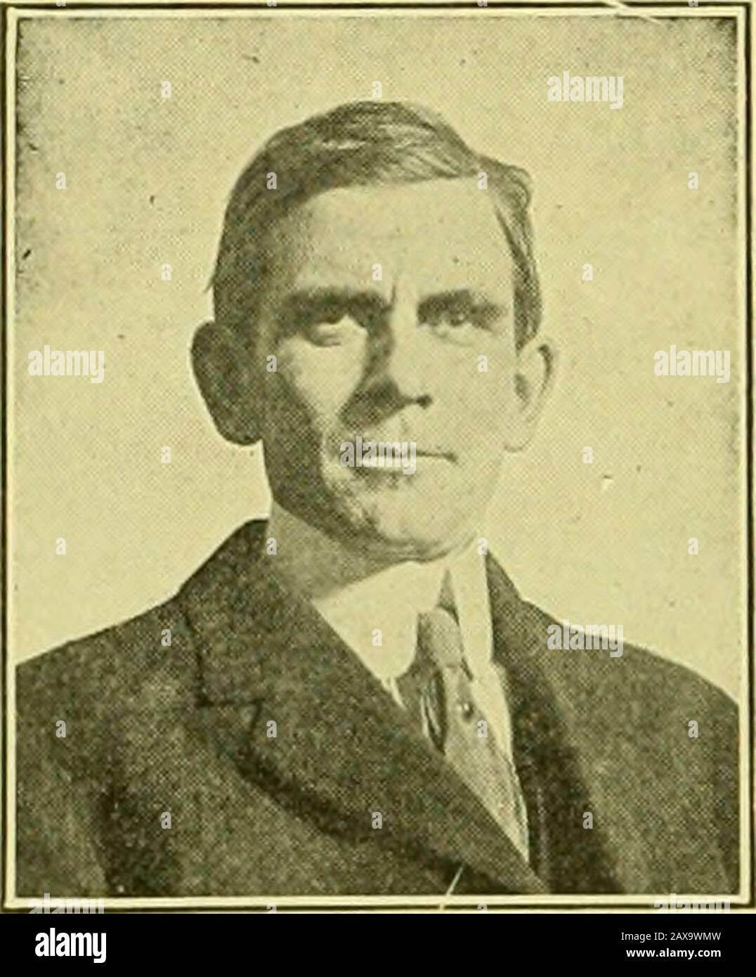 An interrupted operation Stock Photo - Alamy