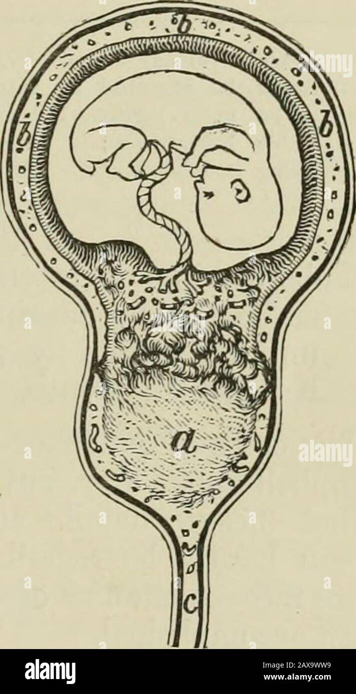 Peritoneal ligament hi-res stock photography and images - Alamy