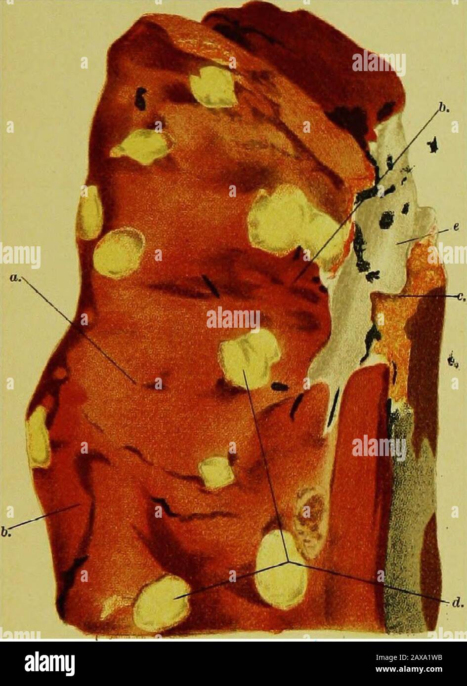 Female pig organs hi-res stock photography and images - Alamy