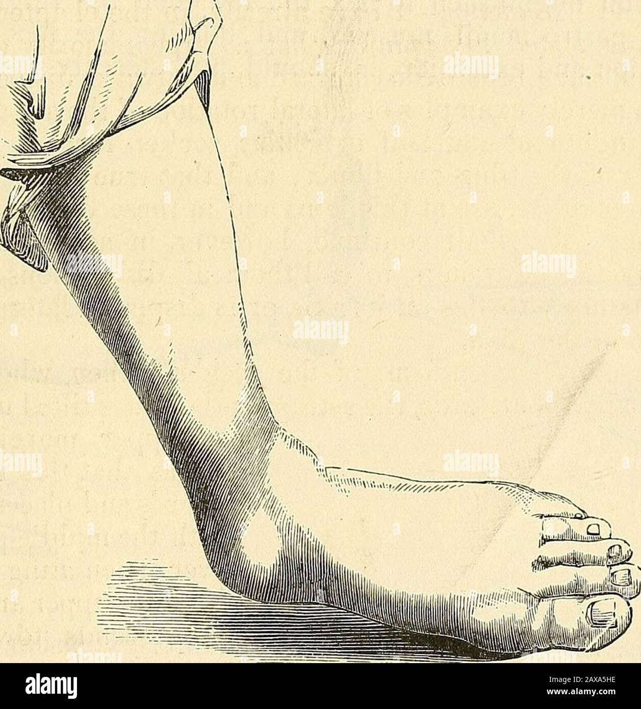 Lateral displacement hi-res stock photography and images - Alamy