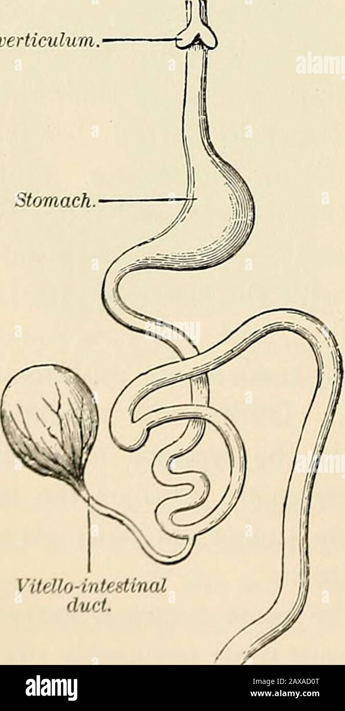 Intestinal tumors hi-res stock photography and images - Alamy