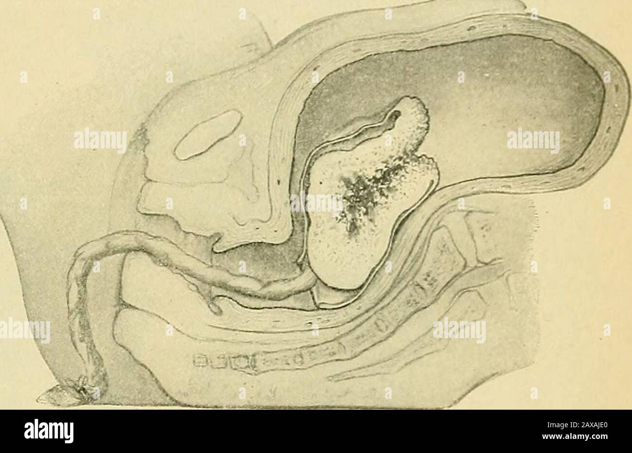 The practice of obstetrics, designed for the use of students and ...
