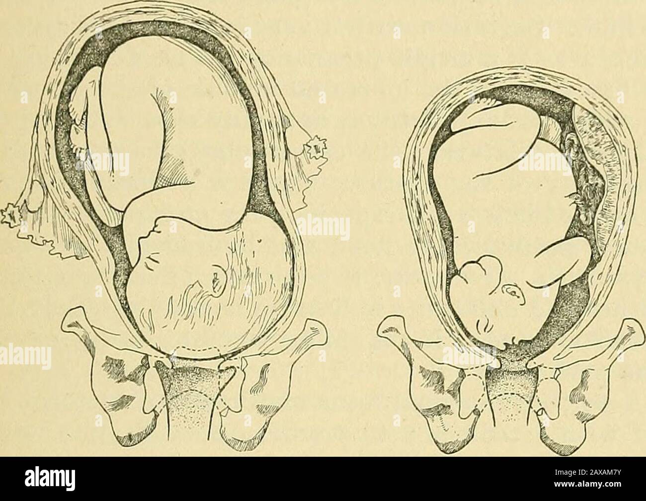 The practice of obstetrics, designed for the use of students and ...