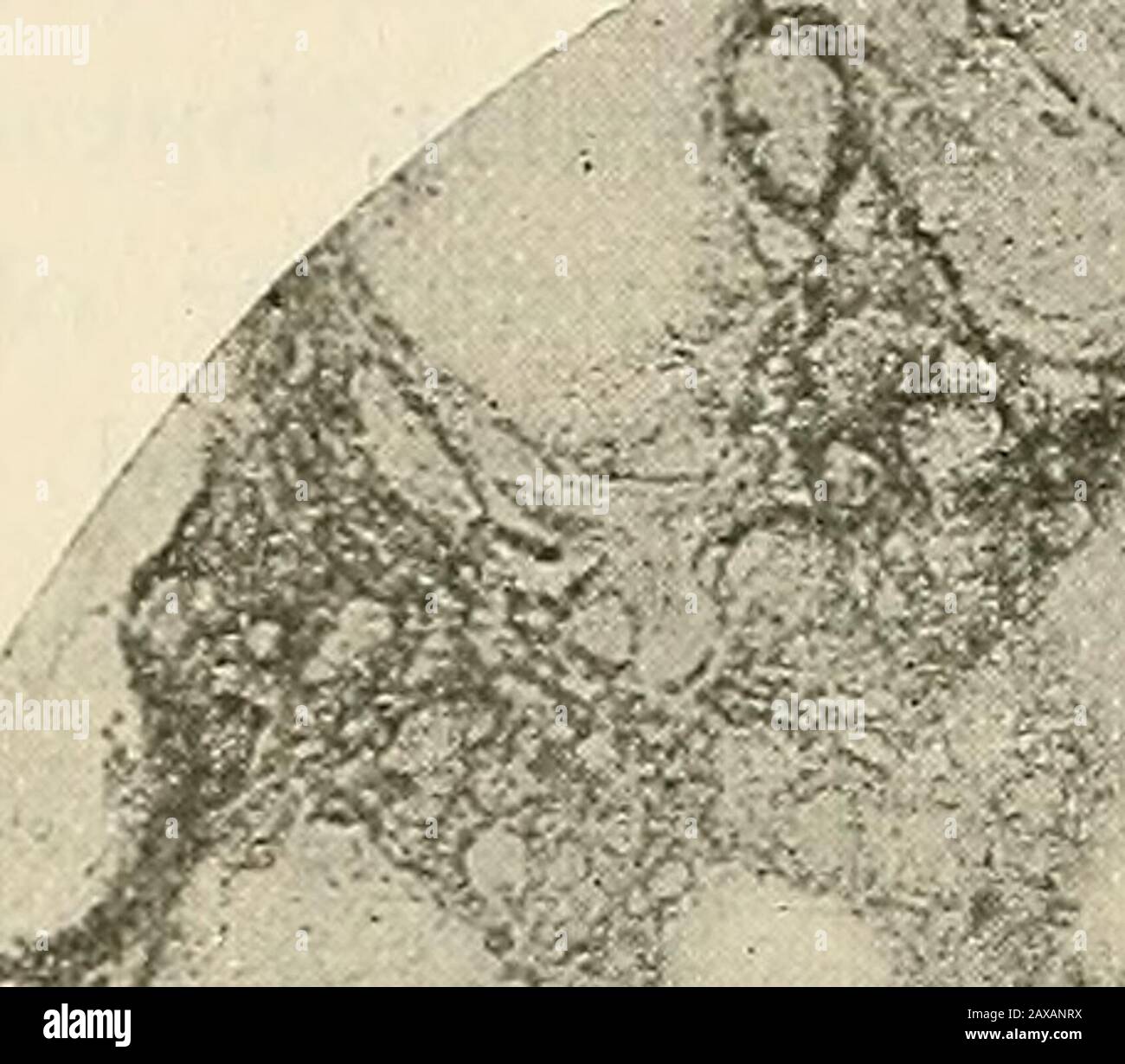 The pathology and surgical treatment of tumors . p-tion than are the ...