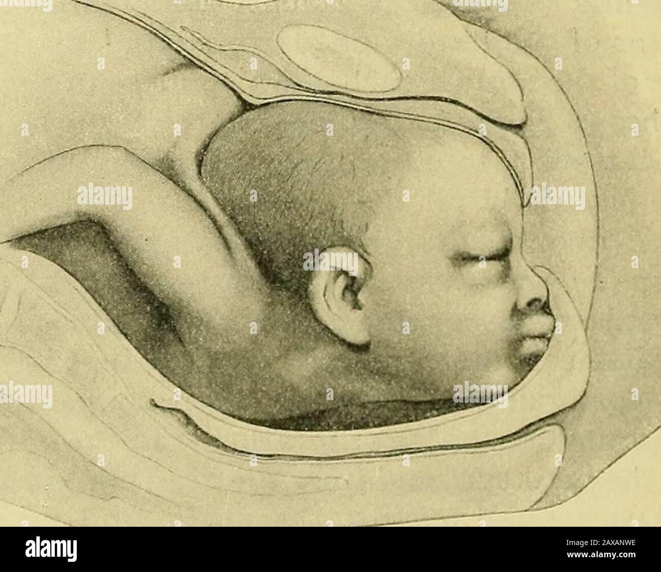 Podalic version hi-res stock photography and images - Alamy