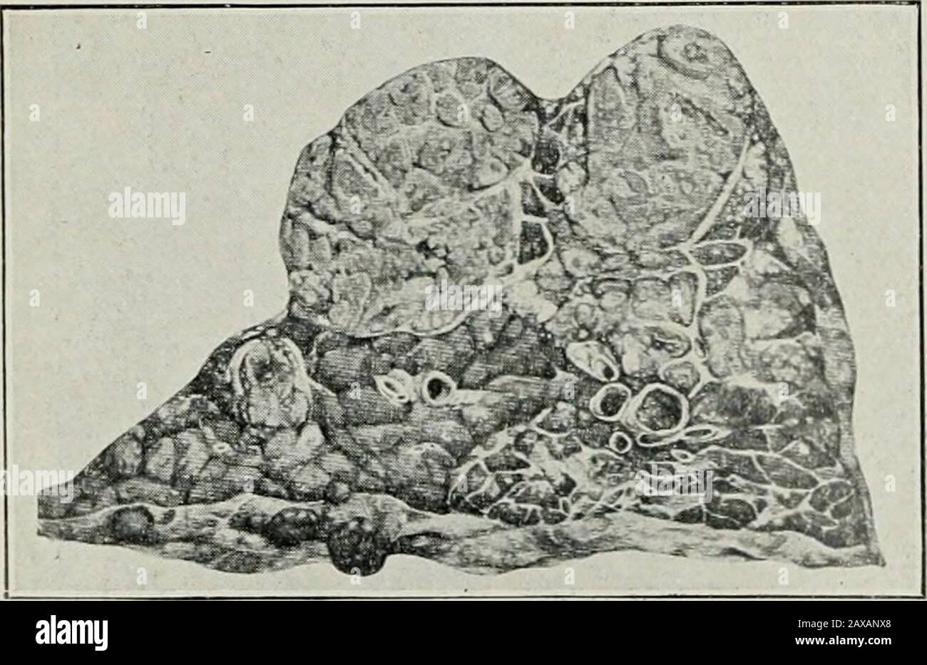 Upon gaining hi-res stock photography and images - Alamy