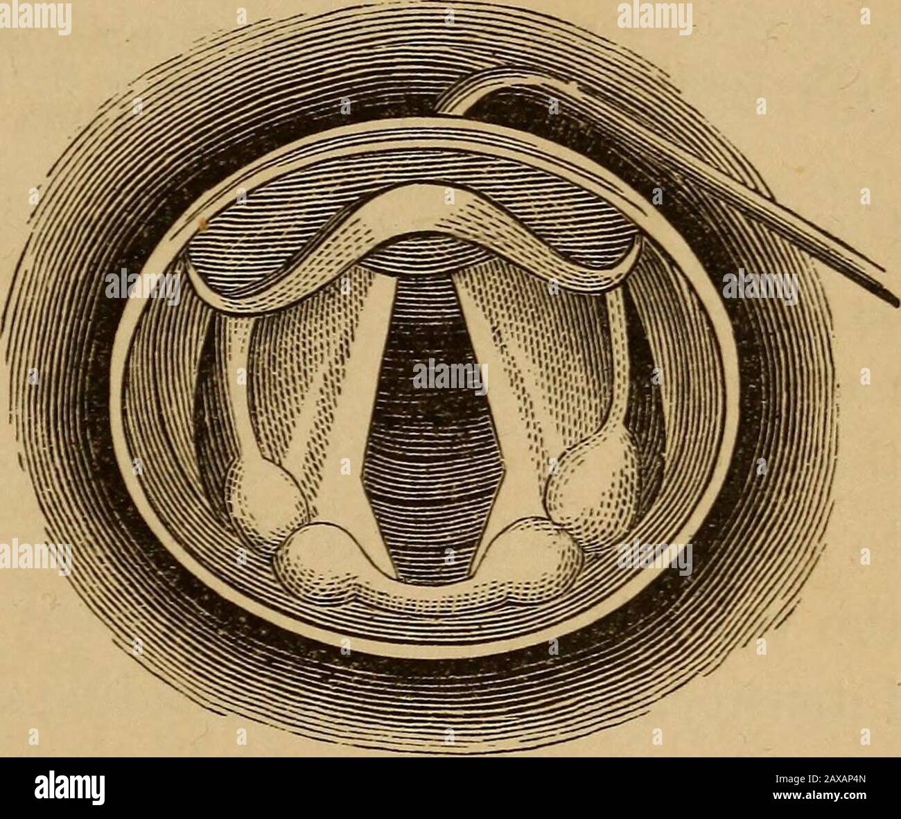 True vocal cords High Resolution Stock Photography and Images - Alamy