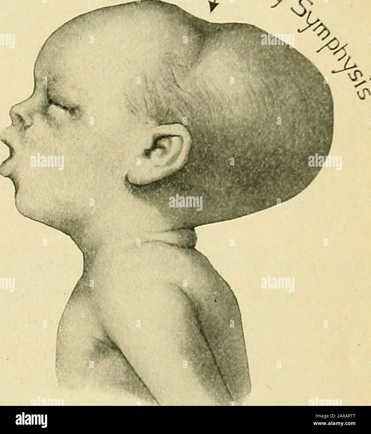 The practice of obstetrics, designed for the use of students and ...