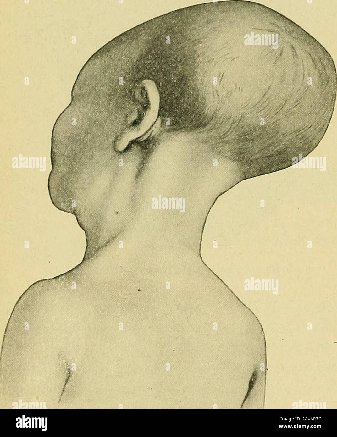 Pos ellipse hi-res stock photography and images - Alamy