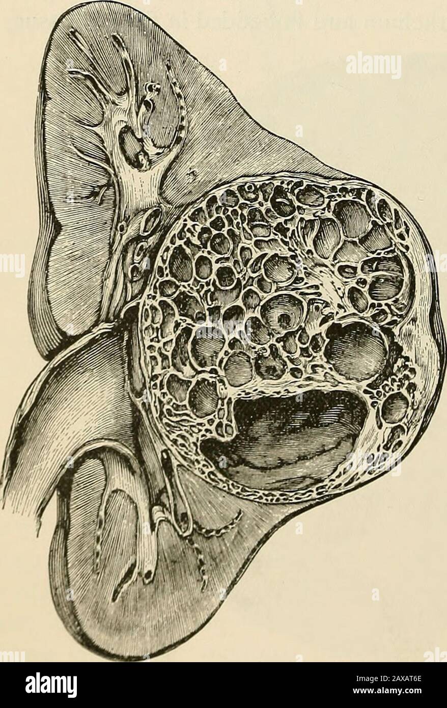 The pathology and surgical treatment of tumors . fiian-body rests may ...