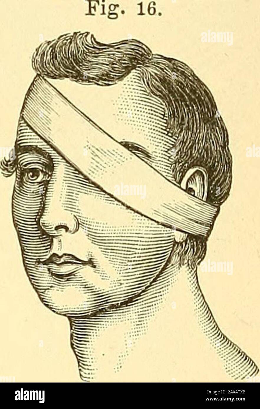 Scheitelbein hi-res stock photography and images - Alamy