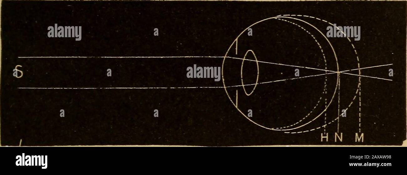 Inverted image in lens hi-res stock photography and images - Alamy