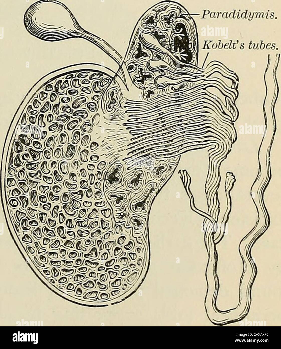 The pathology and surgical treatment of tumors . large number of cysts ...