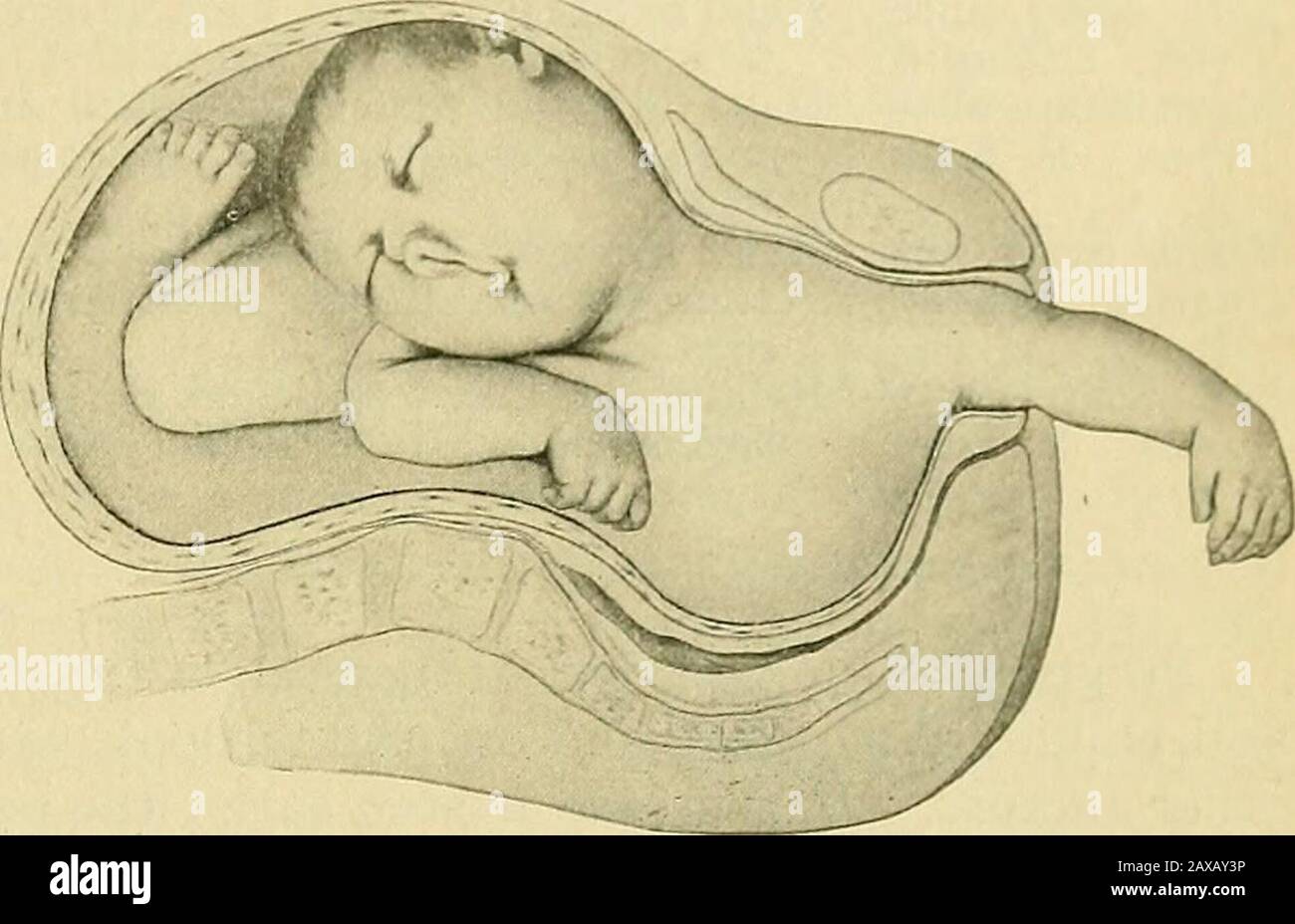 The practice of obstetrics, designed for the use of students and ...