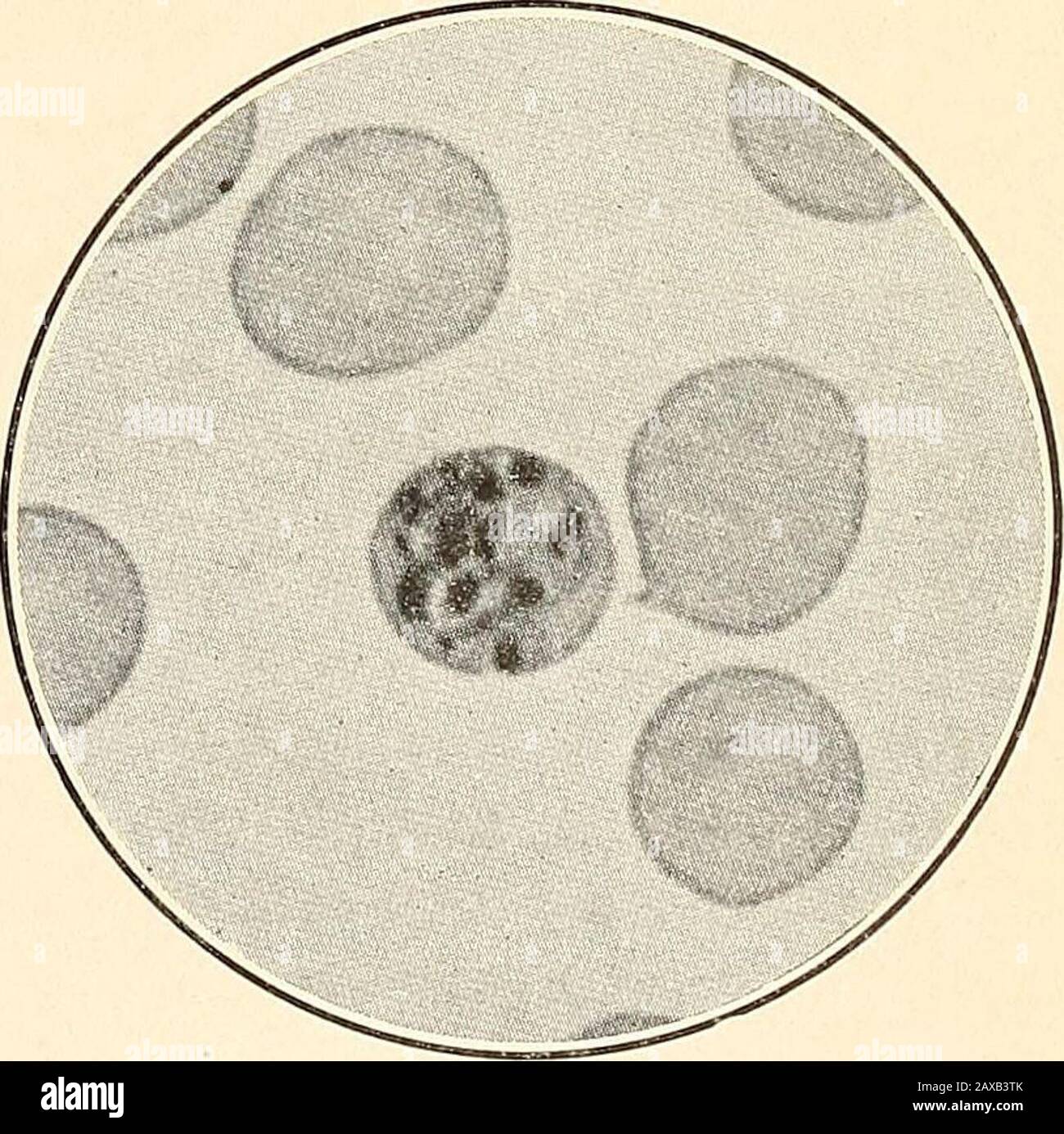 Malarial fevers hi-res stock photography and images - Alamy