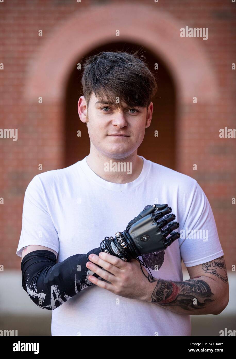 Jack Silverwood 24, with his "bionic" prosthetic hand, he was ...