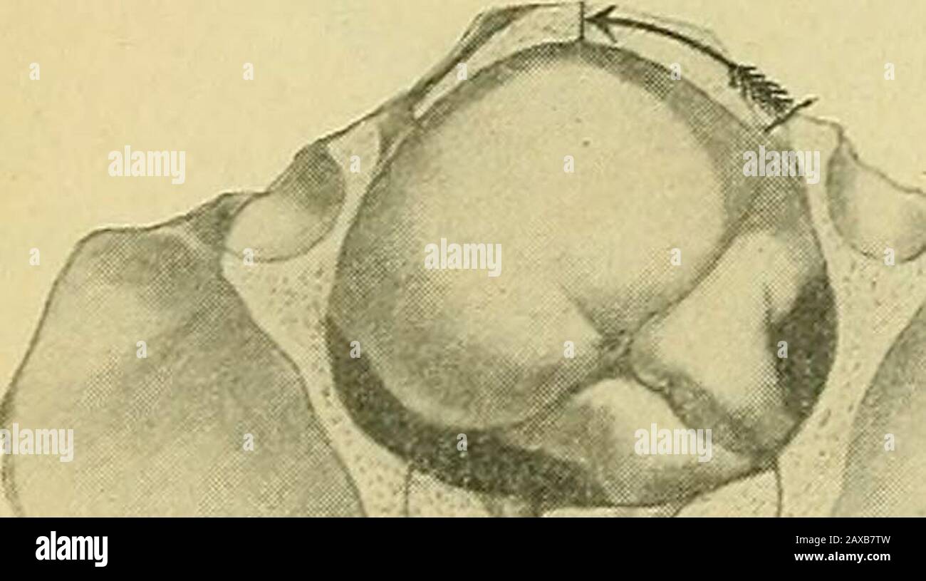 The practice of obstetrics, designed for the use of students and ...