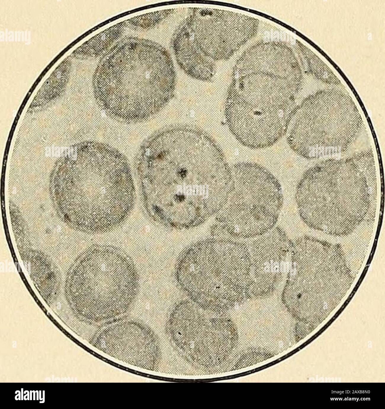 The malarial fevers, haemoglobinuric fever and the blood protozoa of ...