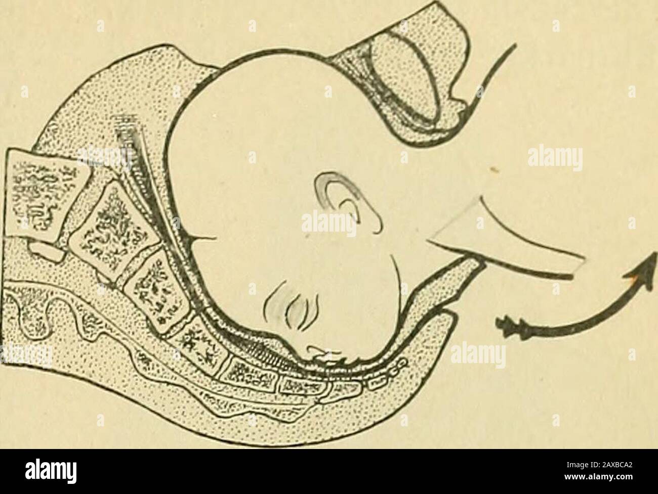 The practice of obstetrics, designed for the use of students and ...