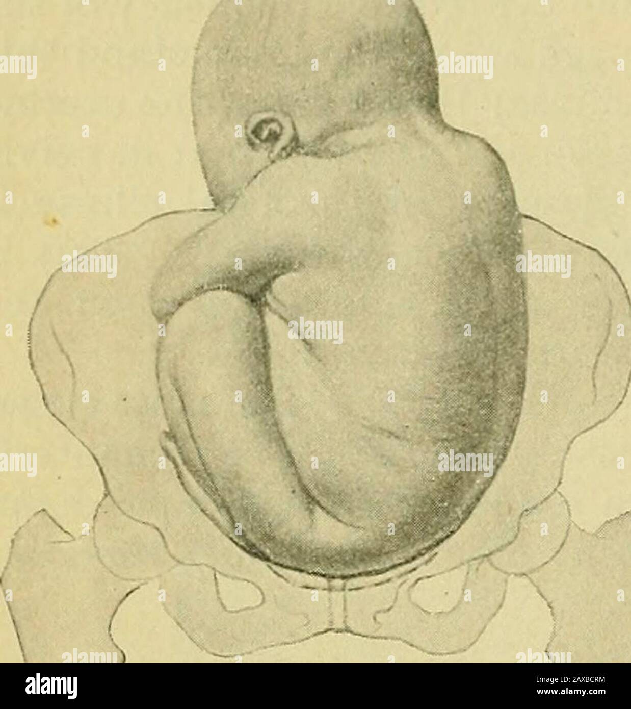 The practice of obstetrics, designed for the use of students and ...