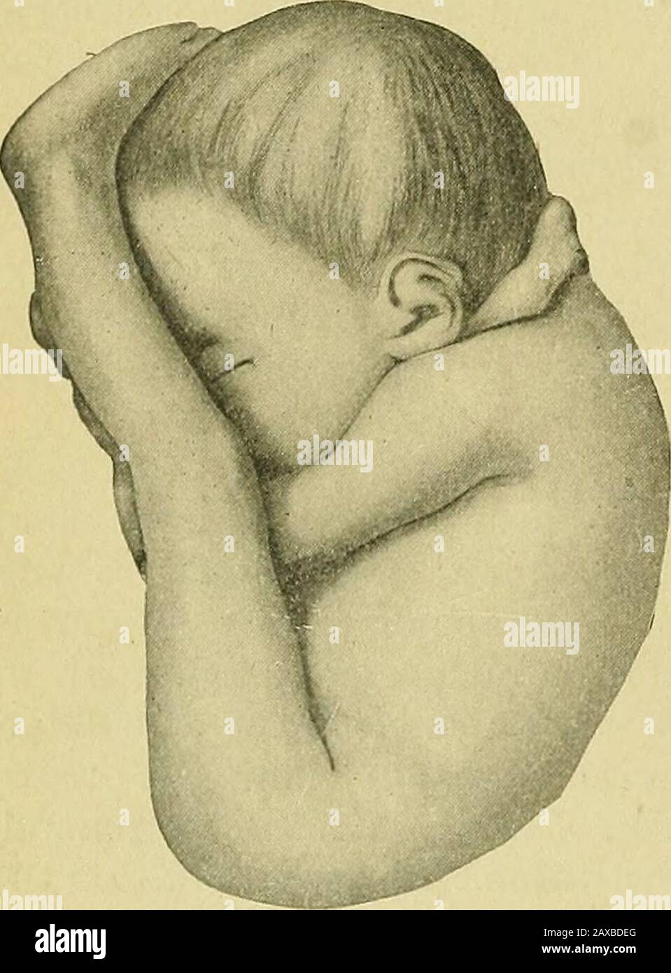 The practice of obstetrics, designed for the use of students and ...