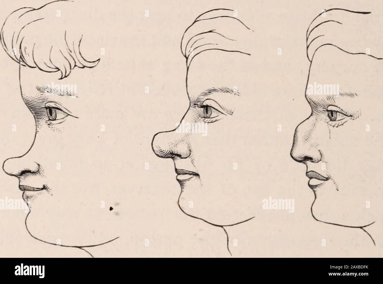 Buffalo medical and surgical journal . nents fist, falls from a horse ...