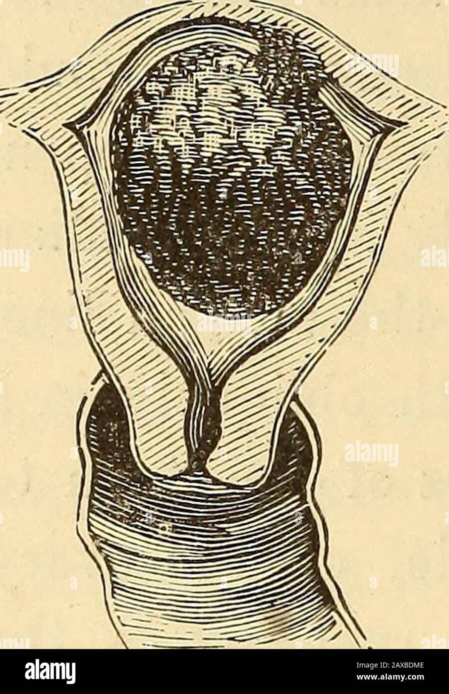 A treatise on the medical and surgical diseases of women, with their ...