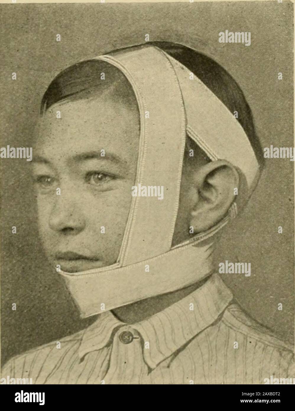 Tubing used in operations hi-res stock photography and images - Alamy