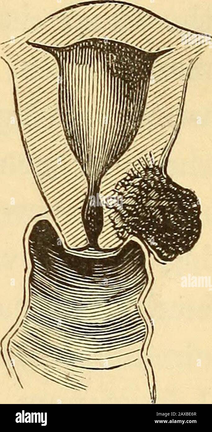 A treatise on the medical and surgical diseases of women, with their ...