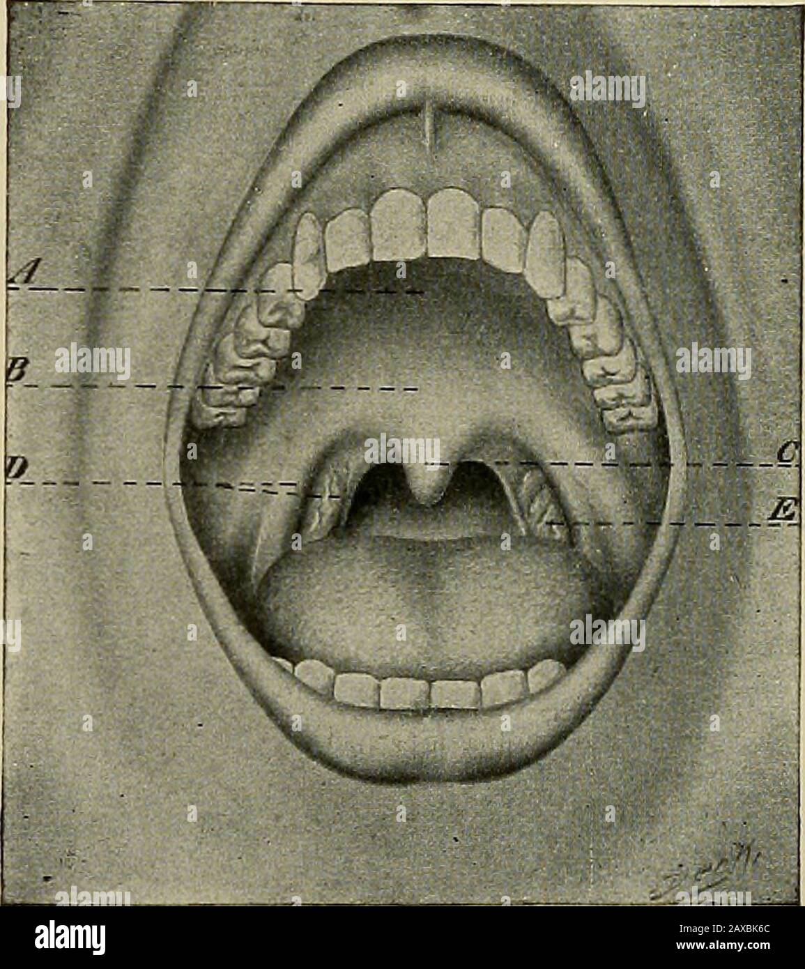 Bartholin glands hi-res stock photography and images - Alamy